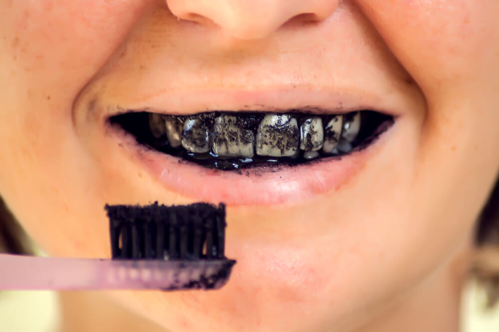 Dental Fads to Avoid - Toothbar